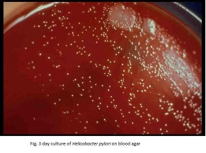 Egg yolk emulsion agar Archives - Microbiology Notes